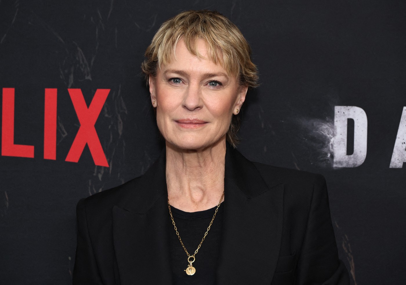 Glumica TOTALNO DRUGAČIJA nakon ovog postupka - Bila je raskošna ...