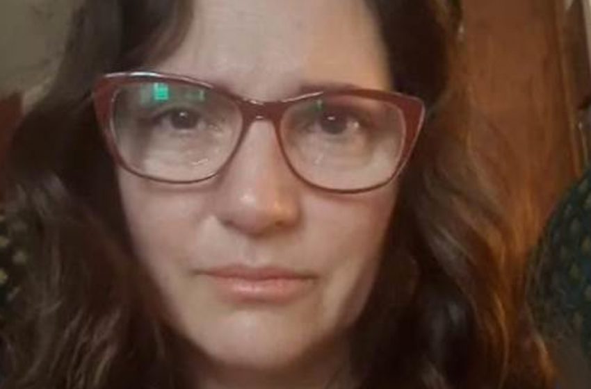 Ovako IZGLEDA posle INTERVENCIJE: Oglasila se Milica Milša nakon ...