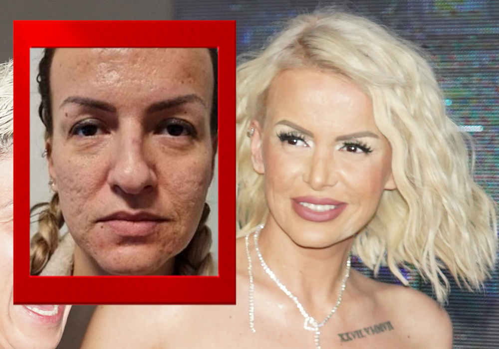 DALA JE 15.000 EVRA NA OPERACIJE, ALI NE STAJE: Ermina Pašović otišla ...