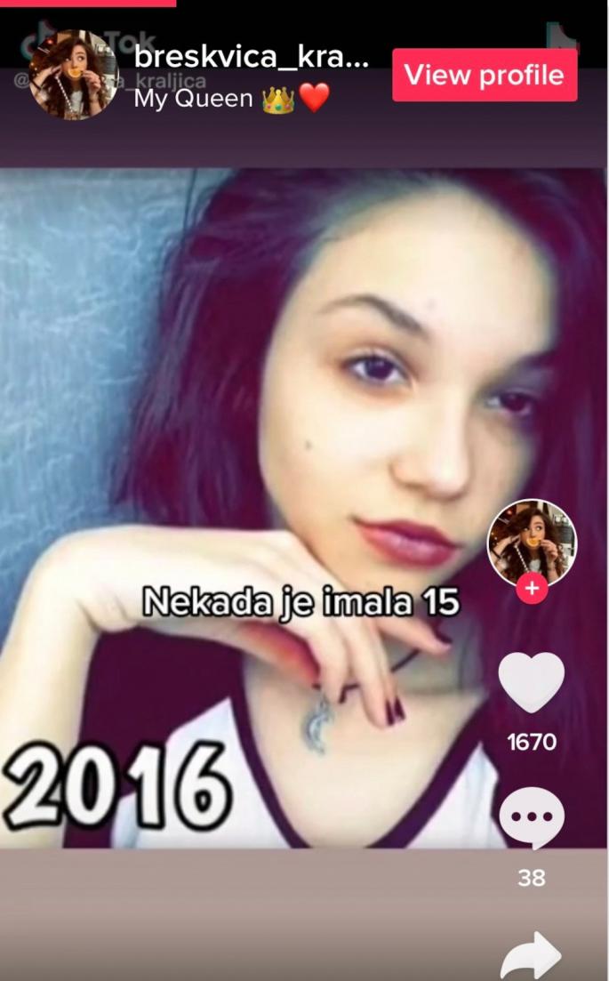 NEPREPOZNATLJIVA - Danas je NAJPOZNATIJA PEVAČICA, a pogledajte kako je izgledala pre par godina ...