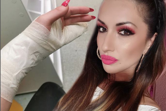 JEZIVE SLIKE PRETUČENE ZVEZDE GRANDA! Udarali je PENDREKOM, ruka u ...