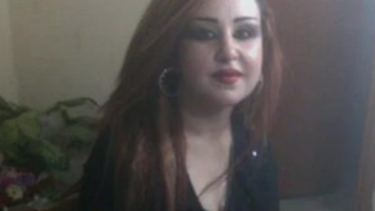 Овако је позната глумица изгледала пре 50 пластичних операција - а данас изгледа као барбика из ...