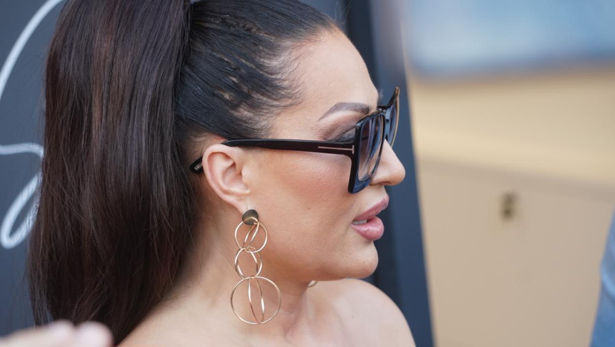 OTVORENA RANA! Ceca se povredila na letovanju! Uhvaćena kako TRČI po ...