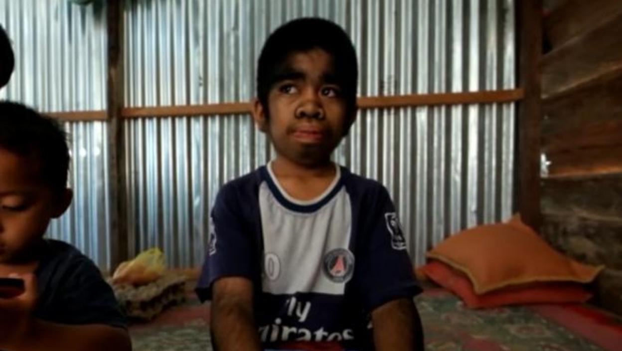 Он је дечак ВУКОДЛАК - не жели операцију, јер верује да је то ДАР од ...