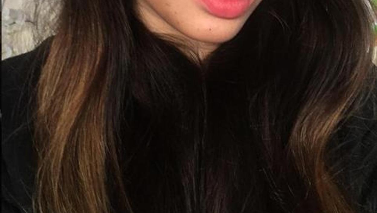 AKNE, DLAKAVE PREPONE I PAZUSI: Lepotica pokazala kako žensko telo ...