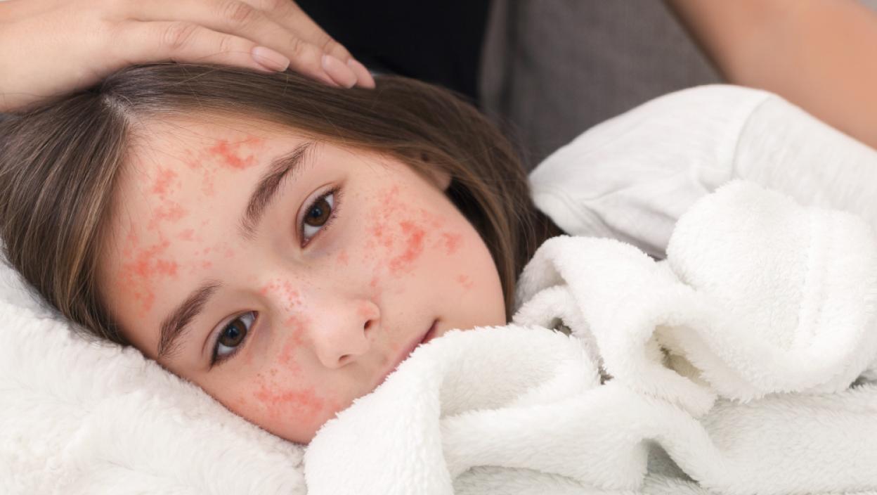 Bolest prljavih ruku za koju roditelji ZBOG OVIH ZNAKOVA u prvi mah ...